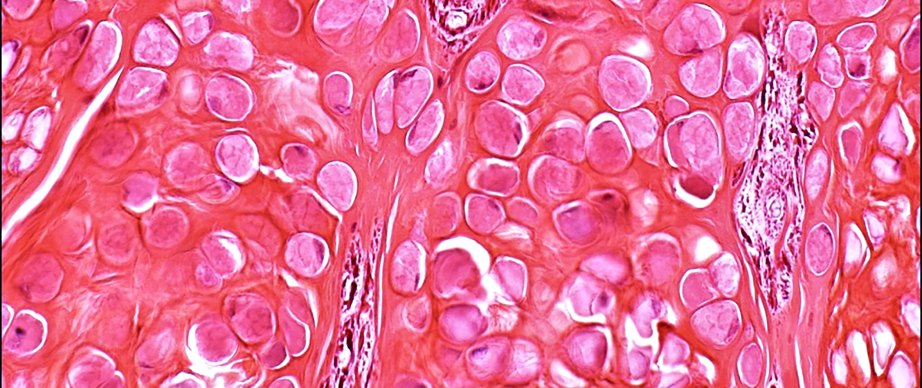 (Innovatie) projecten Palga | Palga